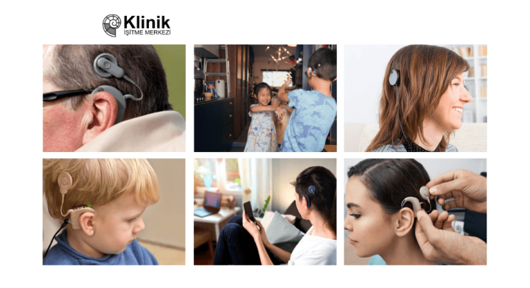Koklear İmplant